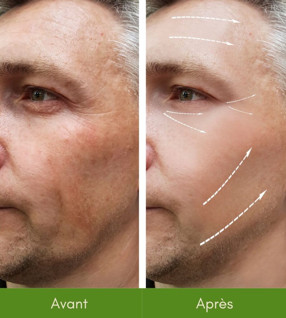 Kobido / Visage Liftant - Formation Massage LFMBE